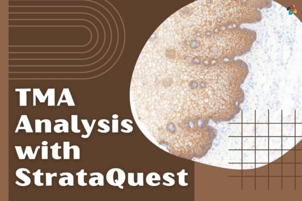 Mastering TMA Analysis With StrataQuest | The Lifesciences Magazine