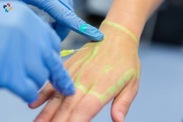 Vascular Closure Devices: Significance, Functionality, And Benefits ...