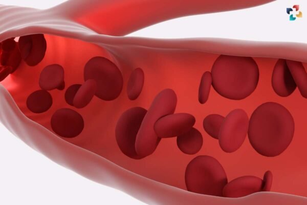 Red Cell Distribution Width: Importance, Interpretation, And Clinical ...