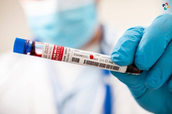 Anion Gap Blood Test: Meaning, Uses, Benefits, And More | The ...