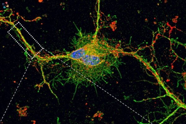 Study Unravels Synaptic Development Mechanism And Autism Links | The ...