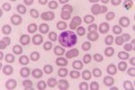 Understanding Absolute Neutrophil Count: Importance, Interpretation ...