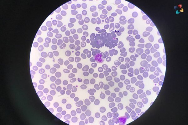Understanding Absolute Neutrophil Count: Importance, Interpretation ...