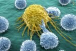 Understanding High Lymphocytes: 5 Causes, Symptoms, And Treatment ...