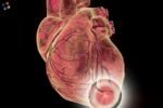 Biotel Heart Monitor: Understanding, Key Features, Benefits, And ...