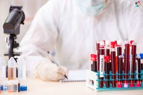 Understanding The Role Of Inflammation Blood Tests In Health Assessment ...