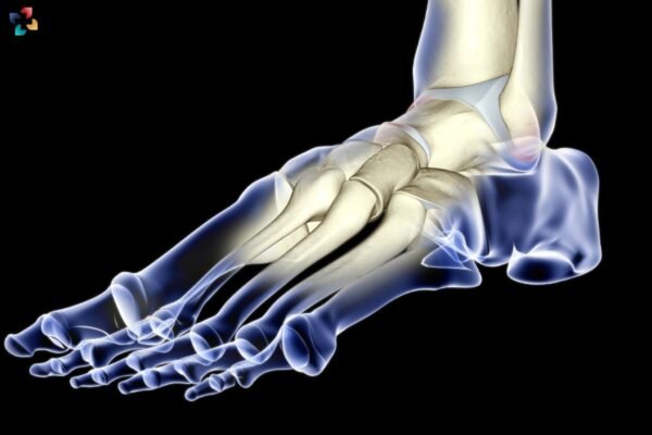 Navicular Stress Fractures: Causes, Symptoms, And Treatment | The ...