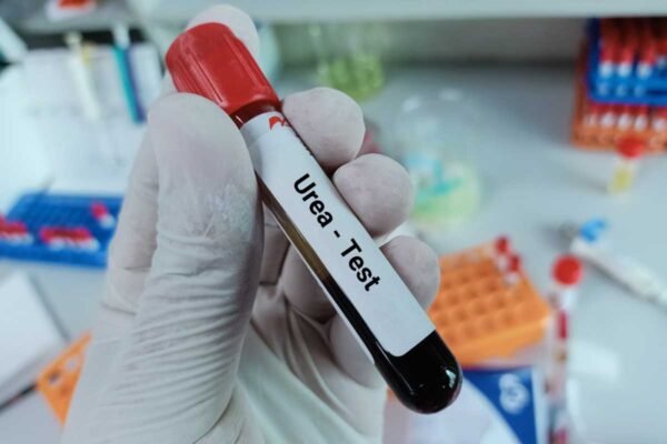 Blood Urea Nitrogen Test: Understanding Its Importance | The ...