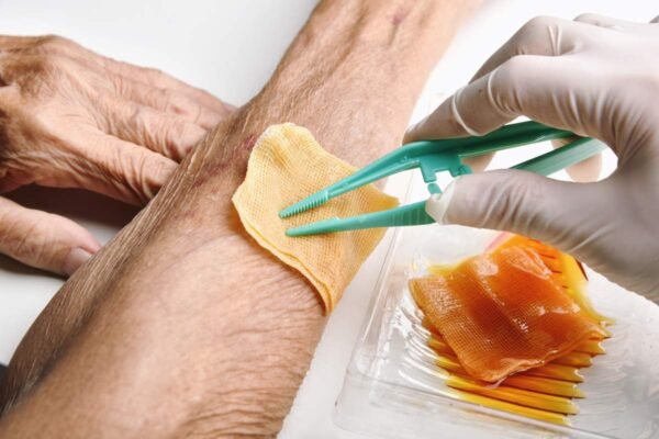 How To Treat Bacterial Skin Infections: #1 Essential Guide | The ...