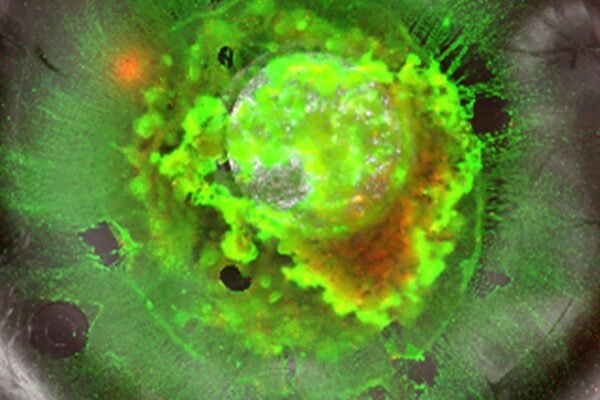Neural Tissue Engineering: 4 Key Components, Applications & Future ...