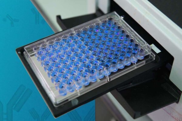 Assay Development In Drug Discovery At Home: Ultimate Guide | The ...