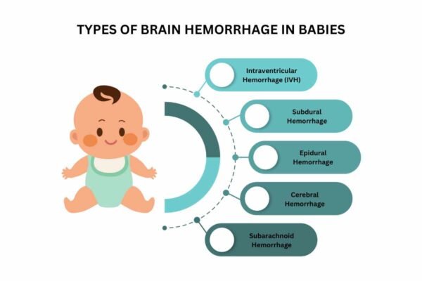 Master In Brain Hemorrhage In Babies: Saving Little Lifes | The ...