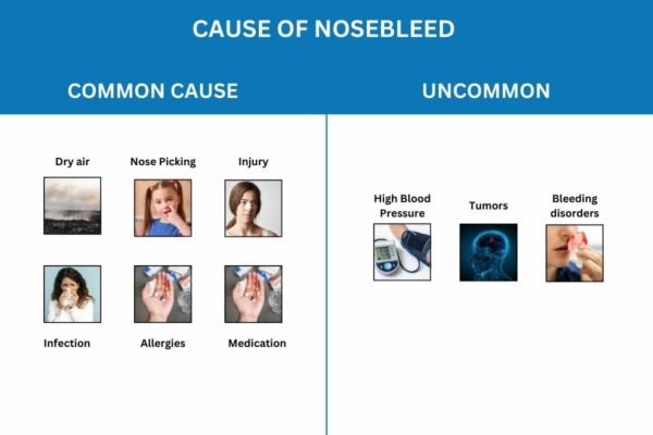 When To Worry About Nosebleeds? Signs(Alarm Bell)! | The Lifesciences ...