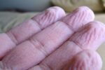 Why Are My Fingers Shriveled? Water To Health Issues | The Lifesciences ...