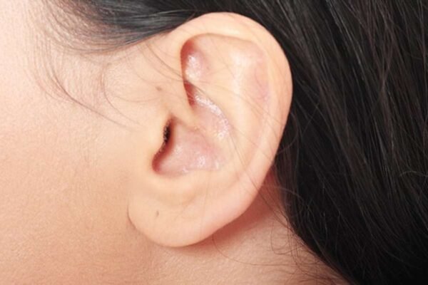 Understand Your Genetics Through The Types Of Earlobes | The ...