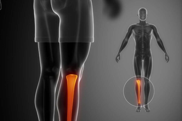 Learn About Tibia And Fibula Anatomy With Labeled Diagram | The ...