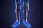 Learn About Tibia And Fibula Anatomy With Labeled Diagram | The ...