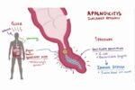 Abdominal Quadrants And Organs Help You Read Your Body Better | The ...